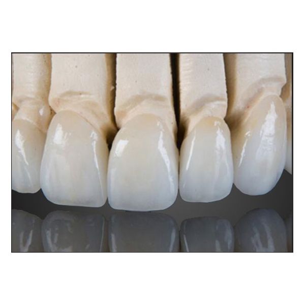 Quality Wieland Zirconia All Ceramic Crown Inner Painting Customized With CAD Design for sale