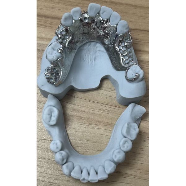 Quality Cast Partial Denture Framework for sale
