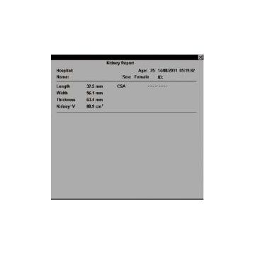 Quality Mobile Ultrasound Machine Digital Laptop Ultrasound Scanner with 100 Frames for sale