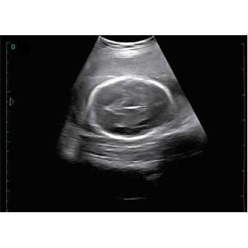 Quality 12 " LCD Screen Portable Ultrasound Device Digital High Resolution With B, B+B, for sale