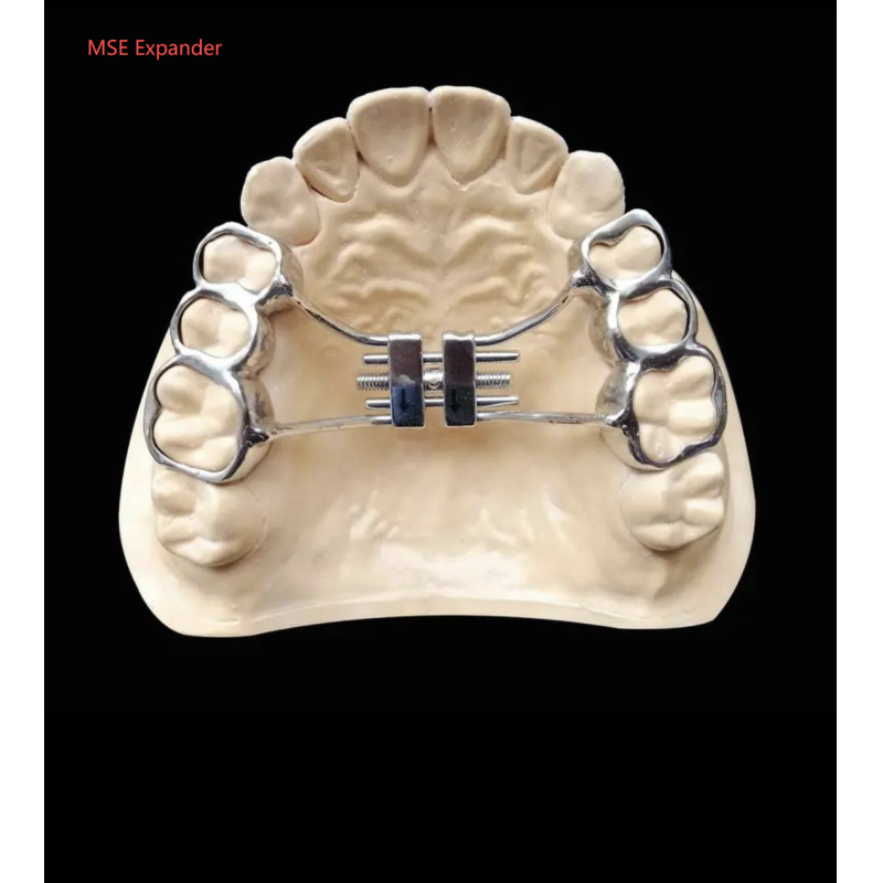 Quality Biocompatible and Clinically Proven Dental Expander - Custom-fitted Maxillary for sale