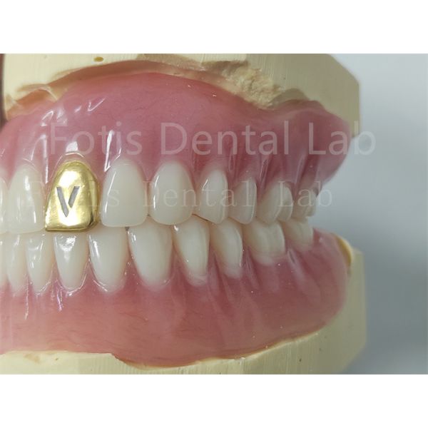 Quality Customizable Full Denture Acrylic Teeth Odor Resistant Comfort Fit for sale