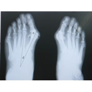 Quality Waterproof X Ray Diagnostic Imaging for sale