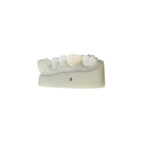 Quality OEM 3D Printed Dental Models CAD CAM Design For Denture Laboratory for sale