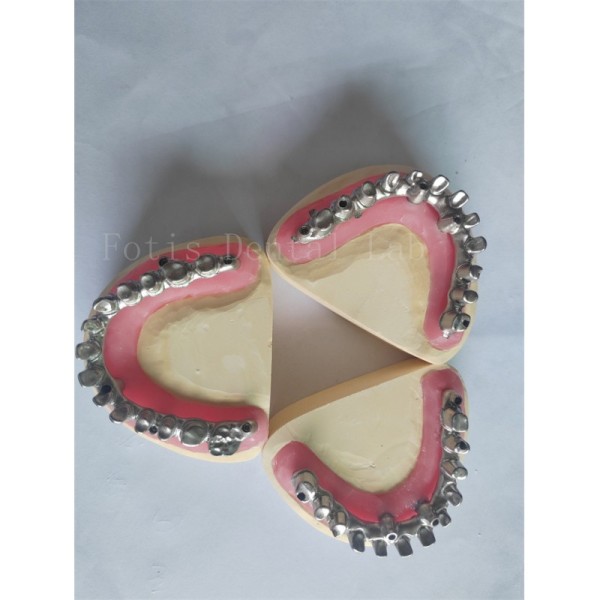 Quality Customized All On 4 All On 6 The Perfect Solution For Dental Implant Restorations for sale