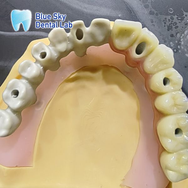 Quality Customize Color Implant Cases with Smooth Surface Nature Design for Universal for sale