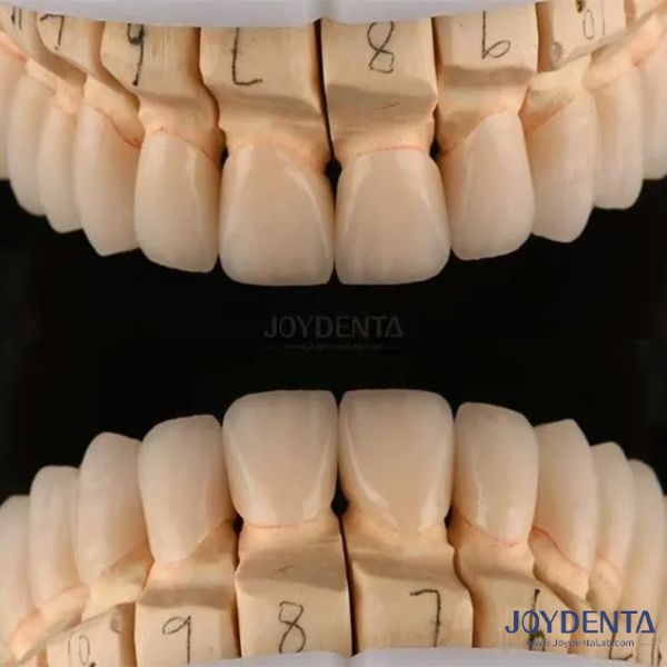 Quality Polished Layered Dental Zirconia 0.3-0.5mm Thickness With CAD CAM Technology for sale
