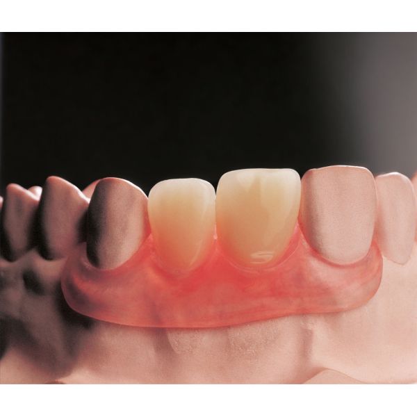 Quality Flexible Flipper Removable Dentures Clinical Removable Partial Prosthodontics for sale