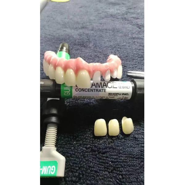 Quality Flexible Individual Titanium Removable Dental Crown For Dental Clinic for sale