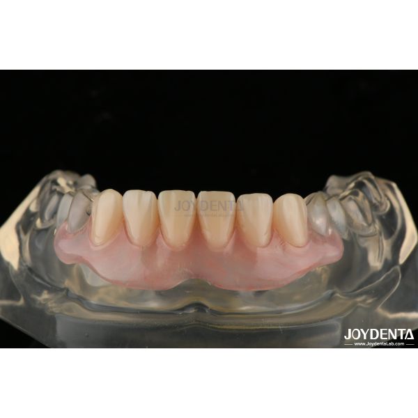 Quality Natural Looking Dental Complete Denture Odor Resistant Adjustable For Proper Fit for sale