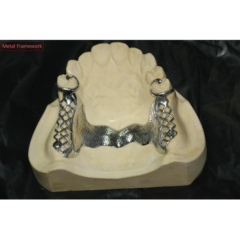 Quality Titanium Alloy Metal Framework for Removable Dentures - Lightweight and High for sale