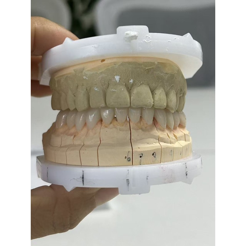 Quality Full Zirconia Dental Crown - Biocompatible High Strength Zirconia Dental Restoration for sale