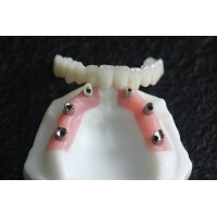 Quality Aesthetic and Biocompatible Zirconia Crown and Abutment for Strong Dental for sale