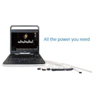 Quality 128 Element Wifi Ultrasound Chison EBit 60 For Cardiovascular for sale