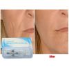 china Hyaluronic Acid Injectable Filler 10ml For Lip Injection Cheeks Chin Augmentatio