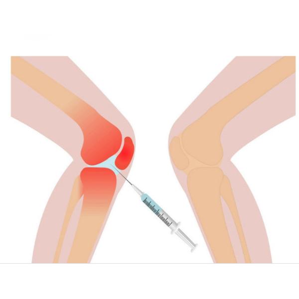 Quality 3ml Knee Pain Mesotherapy Solution Non Crosslinked Hyaluronic Acid for sale