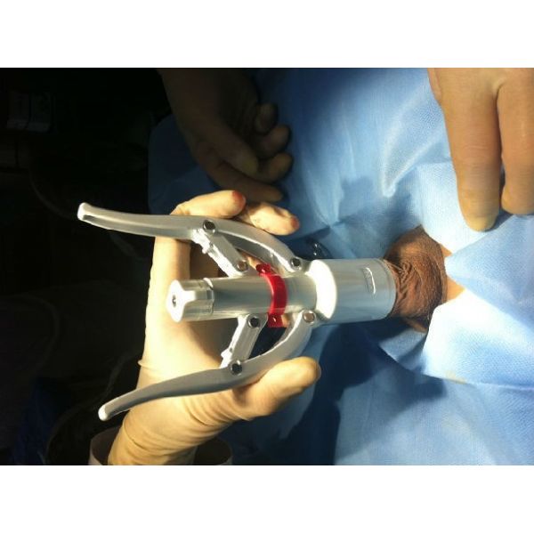 Quality Durable Disposable Circumcision Stapler , Multipurpose Adult Circumcision Device for sale