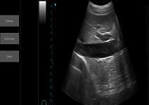 Ultrasound Scan Equipment Portable Ultrasound Scanner Palm Ipad Ultrasound Machine