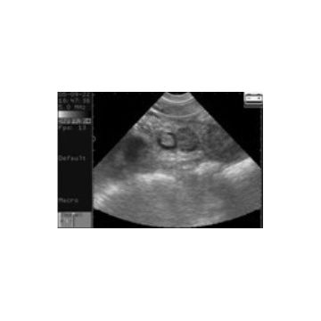 Quality B / W Palm Ultrasound Scanner Animal Ultrasound Scanner Using for Checking Mare for sale
