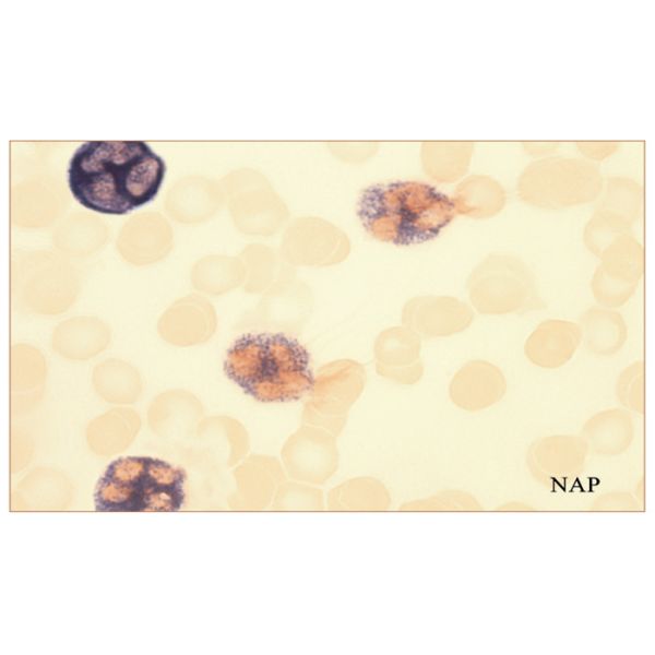 Quality Neutrophilic- Leukocyte Alkaline Phosphatase Stain for sale