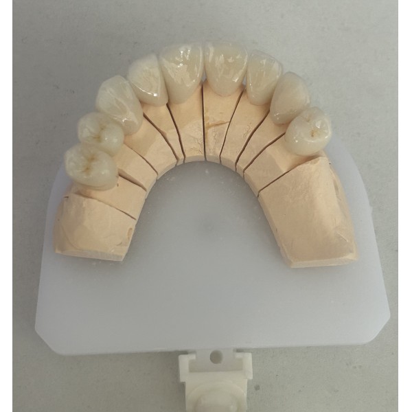 Quality High Translucency Full Zirconia Crown with ≥1200 MPa Strength and CAD/CAM Digital Milling for sale
