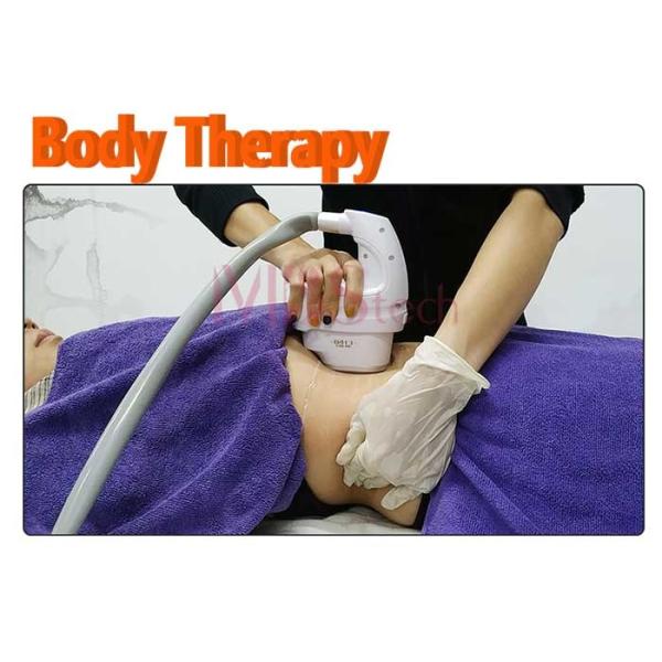 Quality 4Mhz 5D Ice Combine Anti Puffiness HIFU Facial Machine for sale