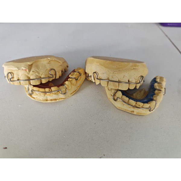 Quality Custom Molded Hawley Retainer with Adjustable Wire for Long-lasting Teeth for sale