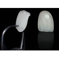Quality Emax Veneer Dental Veneer with Flexural Strength up to ~600MPa Seamlessly Blends for sale
