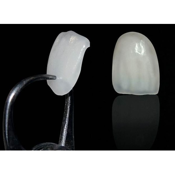 Quality Emax Veneer Dental Veneer with Flexural Strength up to ~600MPa Seamlessly Blends with Natural Teeth and Mimics Natural Color for sale