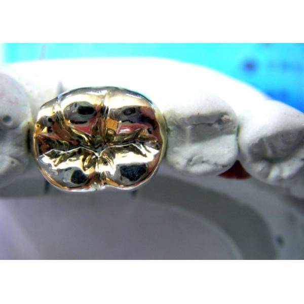 Quality High Stability Semi Precious Dental Crown Bridge PFM Easy Casting for sale