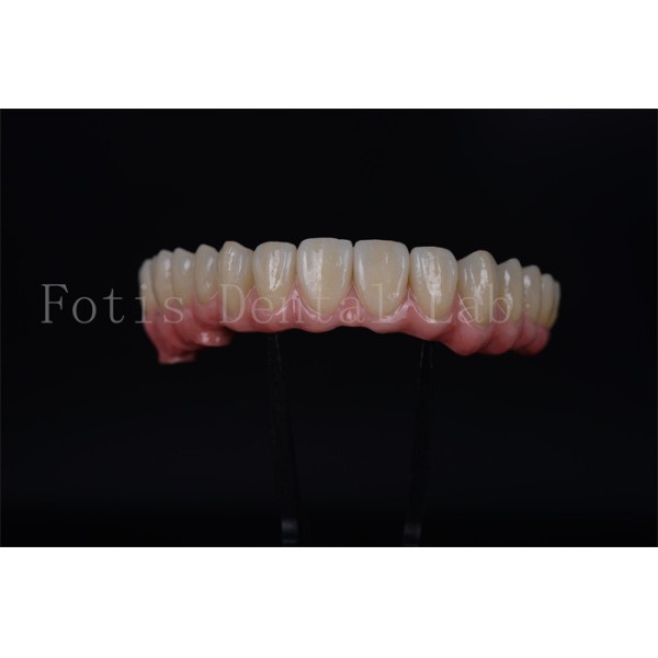 Quality Full Arch Implant Bridge All On 4 All On 6 For Complete Dental Restoration for sale