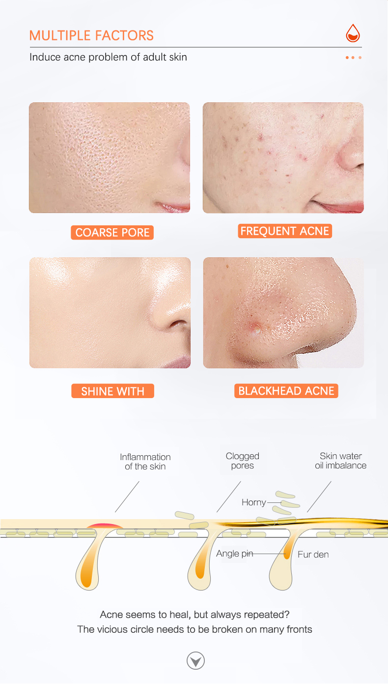 ph balancing toner