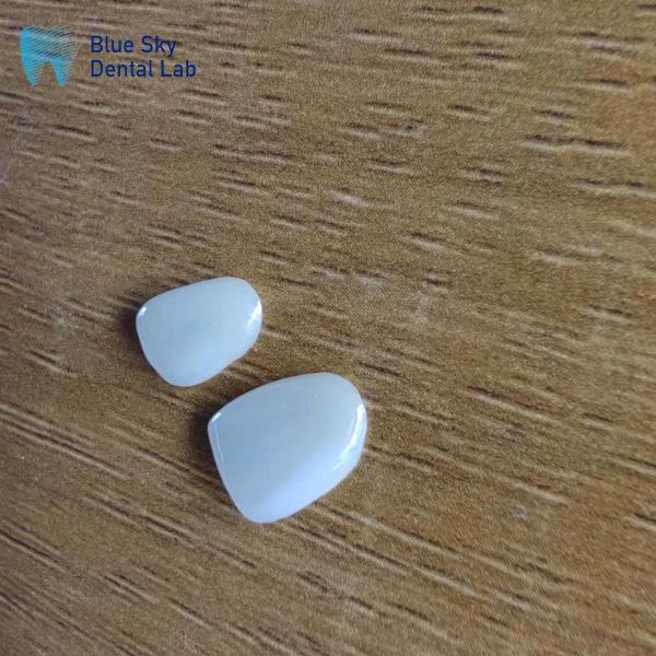 Quality 0.3mm Thin Glass Ceramic Veneer Implants Lightweight Veneer Cases for sale