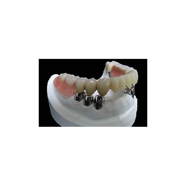 Quality Telescope crowns and denture for sale