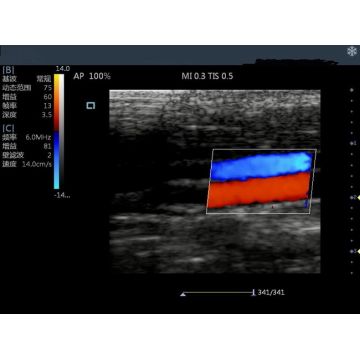 Quality Portable Ultrasound Scanner Color Doppler Machine With 15 Inch LCD Monitor for sale