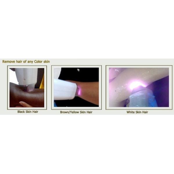 Quality Alexandrite Diode Laser Hair Removal Machine for sale