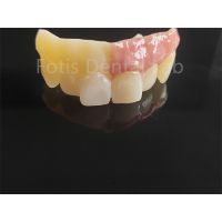 Quality Monolithic Zirconia Layered With Porcelain Computer Aided Design for sale