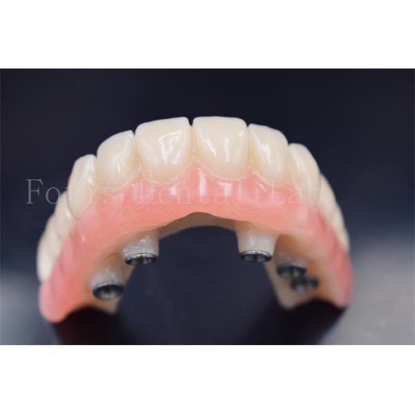 Quality Customized Dental Implants Crowns Replacement Wear Resistance for sale
