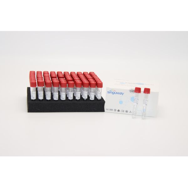 Quality High Precision Viral RNA Isolation Kit RT PCR Product Purification Kit ISO13485 for sale