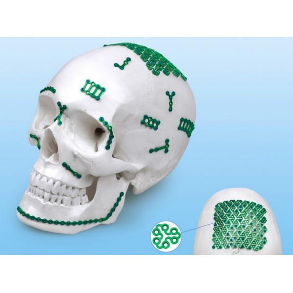 Quality T Shaped Plates Maxillofacial Implants 5 6 Holes Titanium Bone Implants for sale