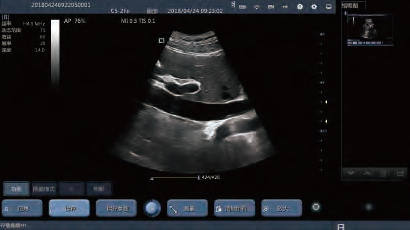 Mobile Phone Probe Wireless Ultrasound Probe Convex Linear Transvaginal Micro-convex Changeable Probe