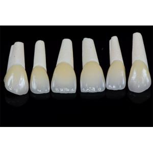 Quality Long Lasting Permanent White Dental Porcelain Veneers Stain Resistance for sale