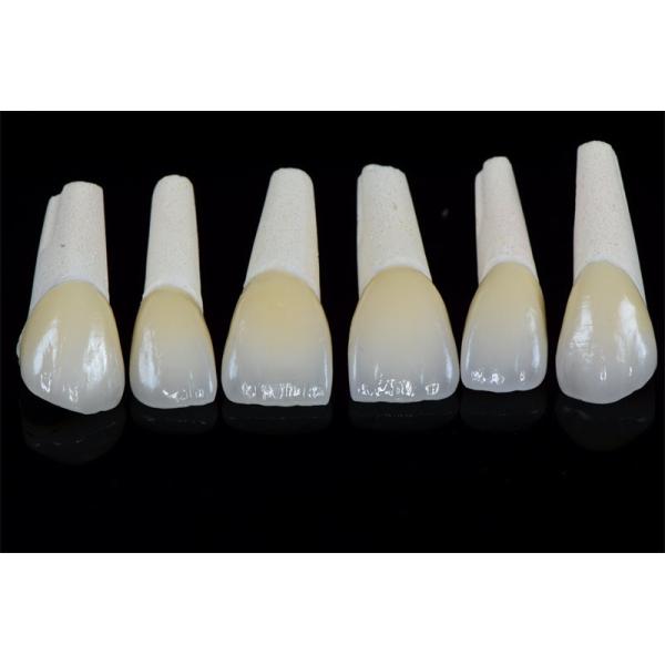Quality Long Lasting Permanent White Dental Porcelain Veneers Stain Resistance for sale