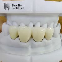 Quality Natural Looking Layered Zirconia High Strength Zircon Multilayer Rectangular for sale