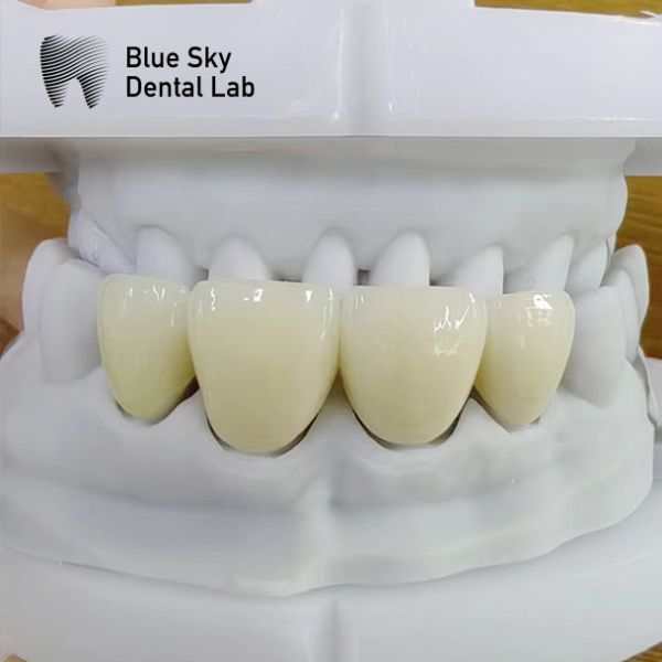 Quality Natural Looking Layered Zirconia High Strength Zircon Multilayer Rectangular for sale