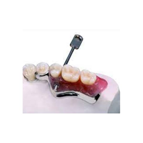 Quality Easy Installation Key And Keyway Dental Attachment Oxidation Resistant for sale