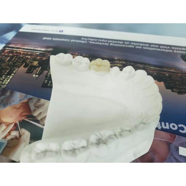 Quality Durable FDA All-Ceramic Dental Crown Veneer Inlay Onlay Similar for sale