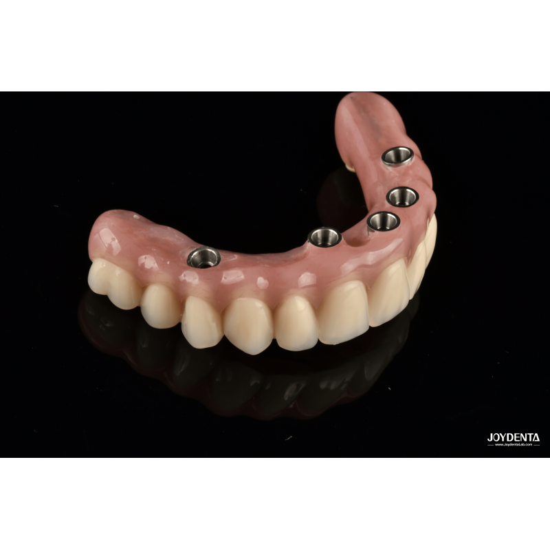 Quality Redefining Full Arch Prosthetics: Unmatched Fit and Function with Our Ti-Base for sale