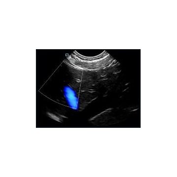 Quality Convex Linear Color Doppler Probe Handheld Ultrasound Scanner With Scanning for sale