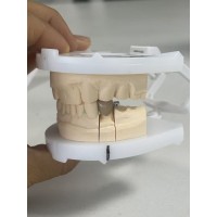 Quality ERA Precision Dental Attachment for High-Accuracy Dental Applications for sale